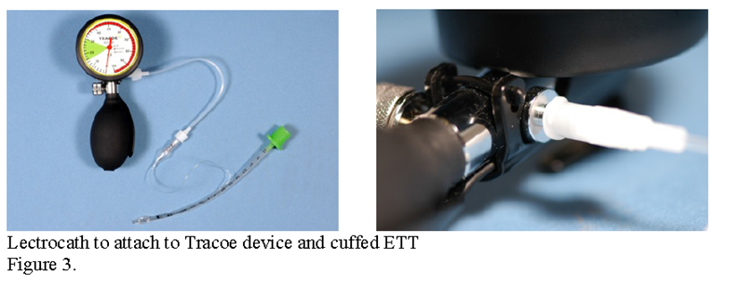 Endotracheal tubes, cuffed | NHSGGC