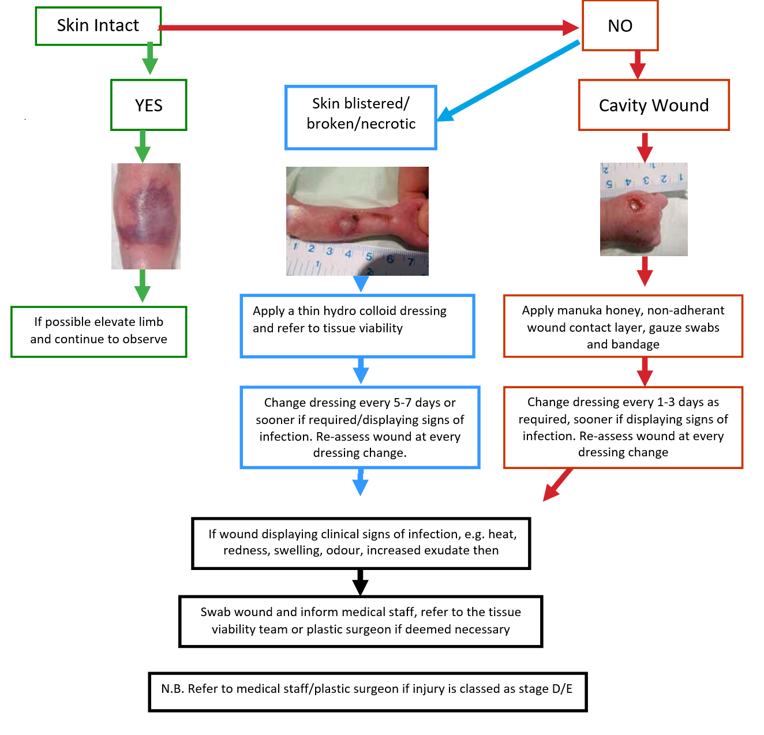 Extravasation injuries: prevention and management (neonatal guideline) | NHSGGC