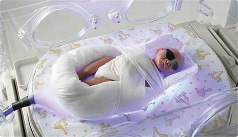 Phototherapy for neonatal jaundice | NHSGGC